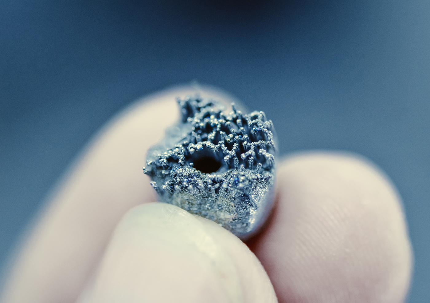 What Materials Are Orthopedic Implants Made Of?